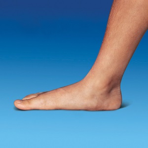 Buchs orthopédie | Medio-pied | Pathologies | 1630 Bulle Suisse